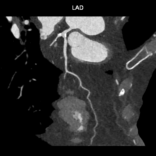 Faculty - Cardiovascular Imaging