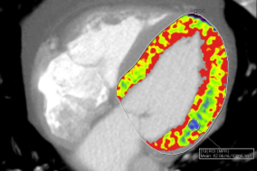 Hands-on Cardiac CT Course - Cardiovascular Imaging